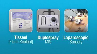 Advanced Surgery Product Guides | Baxter Professional New Zealand