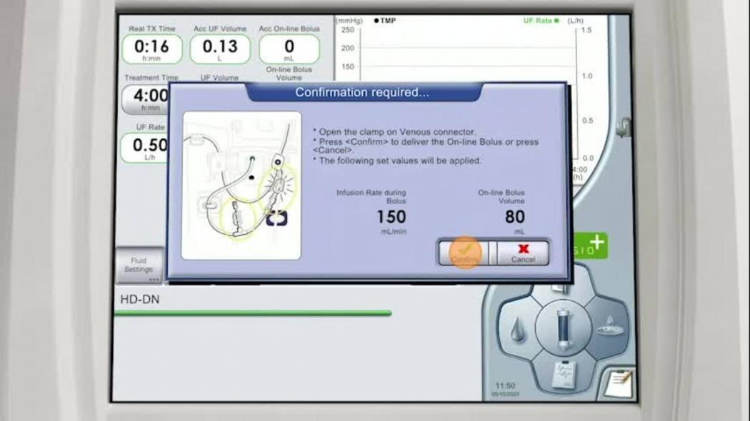 HD Videos | Baxter Professional New Zealand