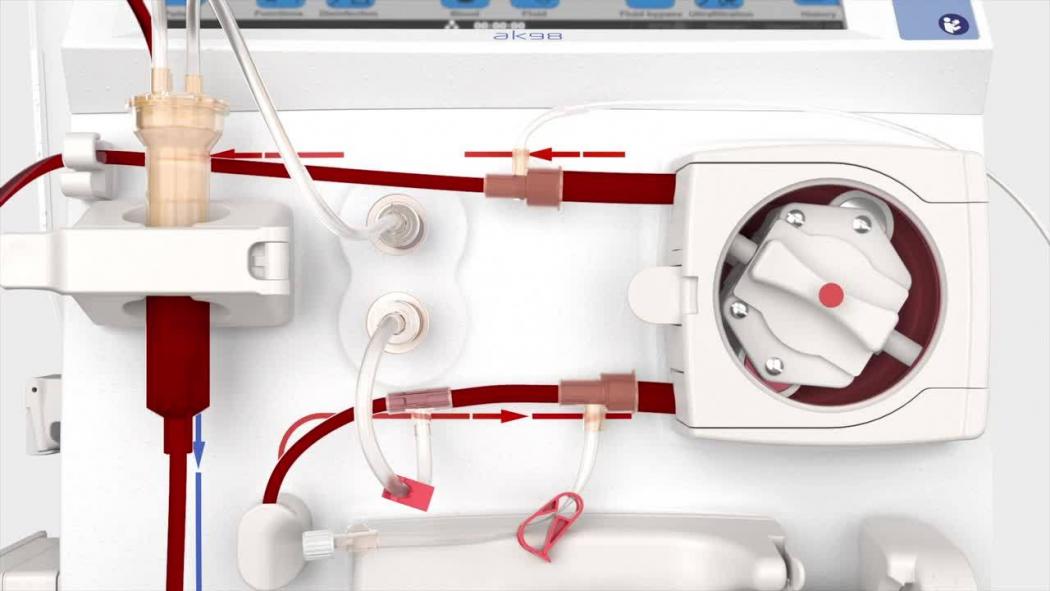 HD Videos | Baxter Professional New Zealand